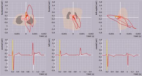 Ecgsim Manual Leads