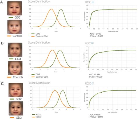 Binary Comparisons A The Gd2 Cohort And Its Age Sex And