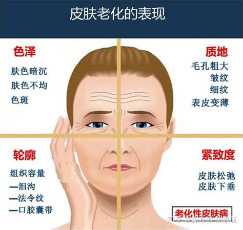 皮肤衰老的4个阶段——护理指南 知乎