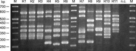 Pcr Ribotype Patterns Of C Difficile Isolates Lanes R1 To R11 Download Scientific Diagram