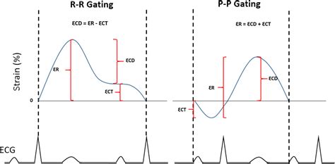 Normal Ranges Of Left Atrial Strain By Speckle Tracking