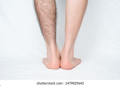 Hair Removal Before And After Photos And Images Shutterstock