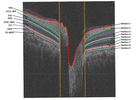 Onh Centered Sd Oct B Scan From A Normal Eye With 9 Manually Segmented