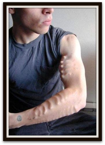 Body Modification Implants