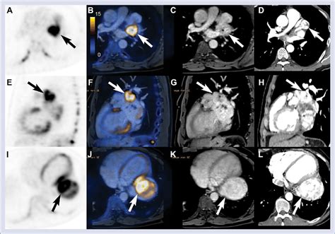 Integrated Advanced Multi Modality Noninvasive Cardiac Imaging Download Scientific Diagram