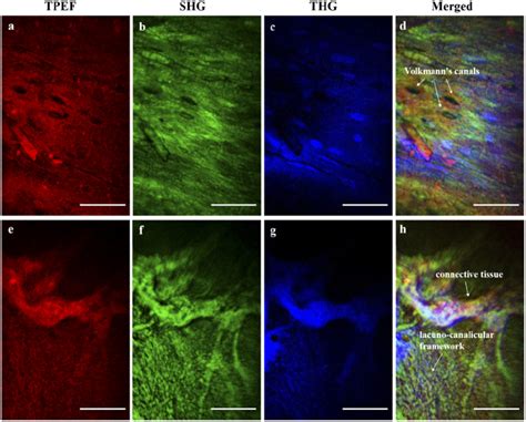 Miniaturized Multimodal Multiphoton Microscope For Simultaneous Two Photon And Three Photon