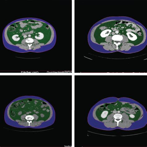 Implementation Of The Scale Invariant Feature Transform Sift Algorithm Download Scientific