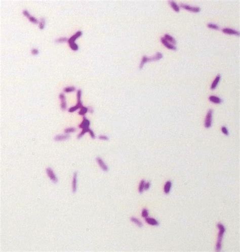 Bacillus Gram Negative Bacilli Gram Stain Microscope Slide Southern Biological
