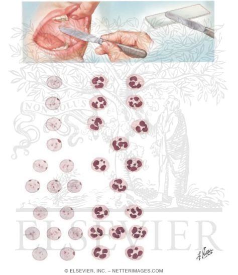 Welcome To Netter Images