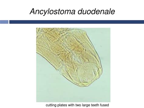 Ppt Hookworm Infection Powerpoint Presentation Id2989455