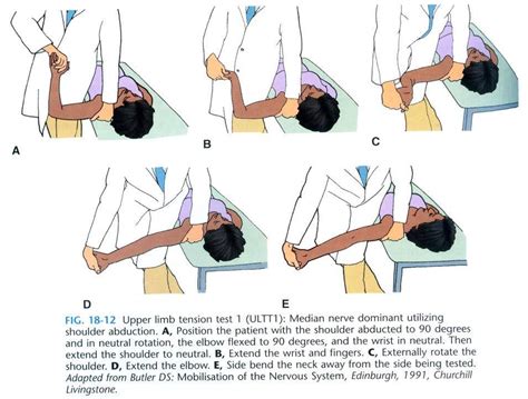 Ultt Upper Limb Tension Test Aka Upper Limb Neural Provocational Test Test C6 C8 Median