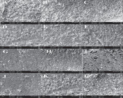 Effect Of Endoactivator And Er Cr Ysgg Laser Irradiation I Journal Of Dr Ntr University