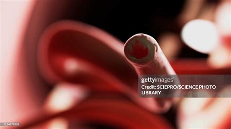 Illustration Of A Hookworm High Res Vector Graphic Getty Images