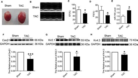 Increased Expression Of Mir‐195 In The Model Of Cardiac Hypertrophy Download Scientific Diagram