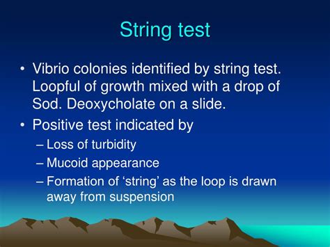 Ppt Vibrio Cholerae Powerpoint Presentation Free Download Id4494882