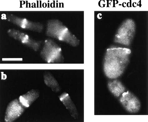 Germination Of Δimp2 Spores Spores From A Homozygous Diploid Were Download Scientific Diagram