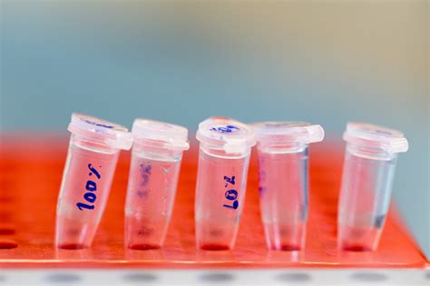 가스 믹서 샘플에 대 한 의료 장비 테스트 실험실에서 가스 크로마토그래피 에 대 한 유리병 건강 진단에 대한 스톡 사진 및 기타 이미지 Istock