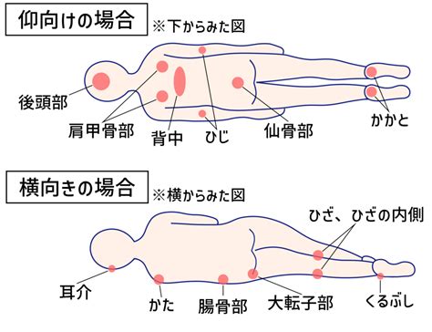 褥瘡とは… 株式会社ウイングル