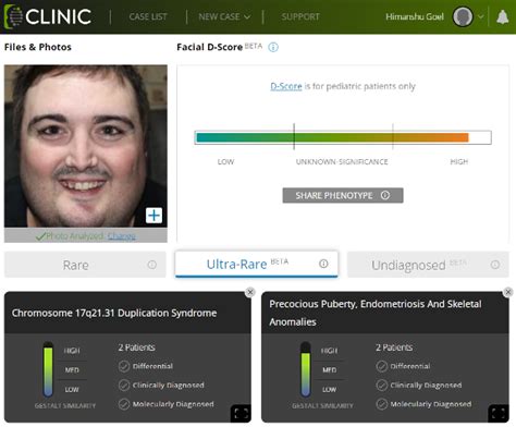 First Patient Diagnosed With Ultra Rare Genetic Syndrome With The Help