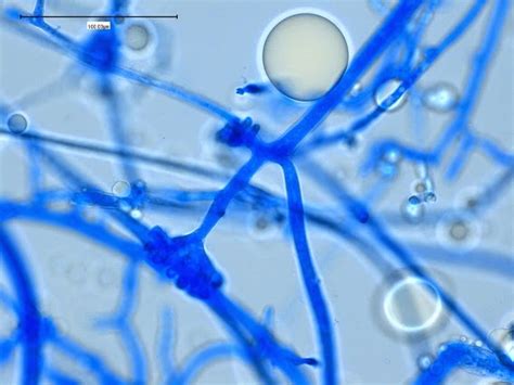 Fun With Microbiology Whats Buggin You Apophysomyces Elegans