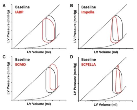 Iabp Ii Flashcards Quizlet