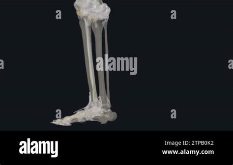 The Interosseous Membrane Of The Leg Is Also Referred To As The Middle Tibiofibular Ligament