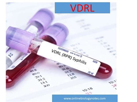 Rpr Test Principle Procedure Result Interpretation And Application