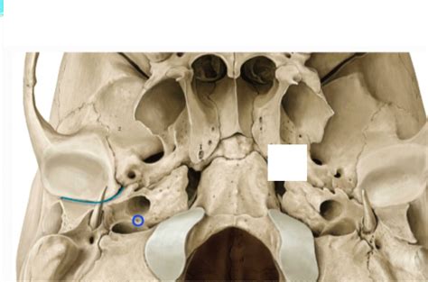 Infratemporal And Temporal Fossa Flashcards Quizlet