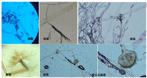 霉菌形态的观察 浙江树人学院化学与生物基础教学实验教学师范中心
