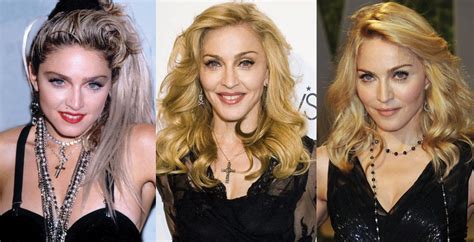 Madonna Plastic Surgery Before And After Pictures 2025