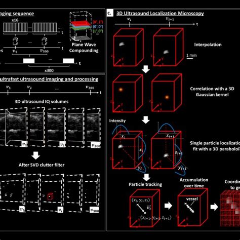 3d Ultrasound Localization Microscopy A Imaging Sequence 16 Plane Download Scientific