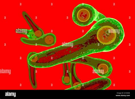 Diphtheria Bacteria Shape