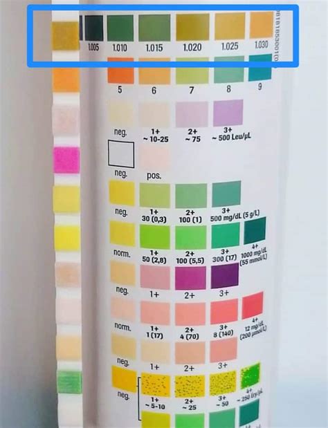 Urine Specific Gravity Test Results Causes And Treatment