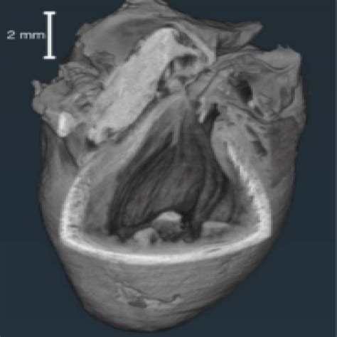 Edge Illumination X Ray Dark Field Tomography National X Ray Computed