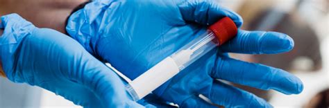 Buildout Of An Automated High Throughput Clia Lab For Sars Cov 2 Testing On A Large Urban Campus