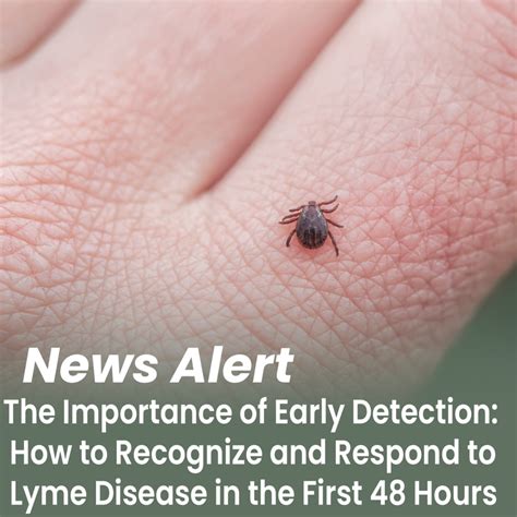 The Importance Of Early Detection How To Recognize And Respond To Lyme