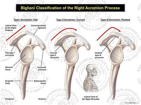 Bigliani Acromion Morfometría Del Acromion Y Sus Implicancias Clínicas