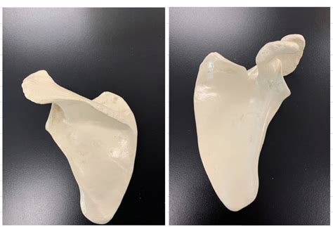 Anatomy Lab Test 3 Scapula Diagram Quizlet
