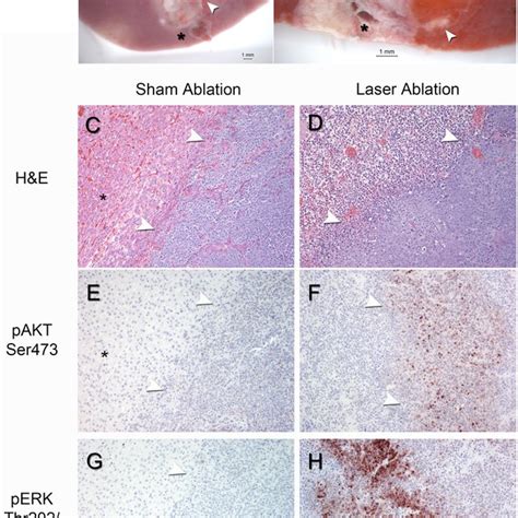 A 1×105 Lt Hsc St Hsc Mpp Clp Cmp Gmp Mep T B And Myeloid