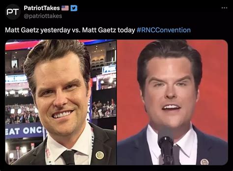 Dr Miami Weighs In On Matt Gaetzs Face Plastic Surgery Rumors