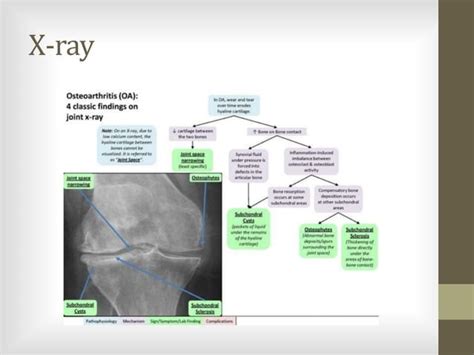 Treatment And Management Of OA 1 Pptx