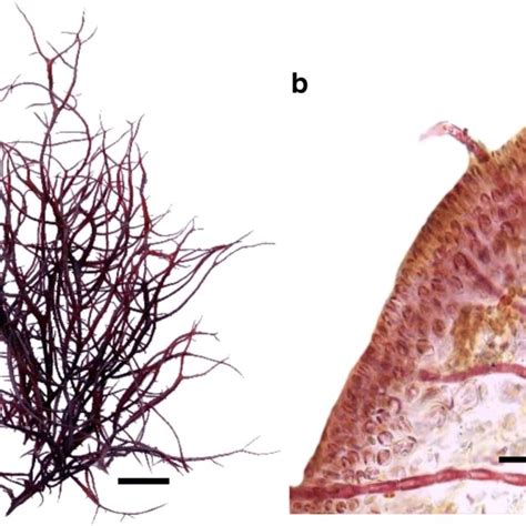 A External Morphology Of Chondracanthus Chamissoi Characterized By