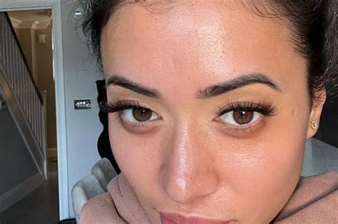 Love Islands Kaz Crossley Bravely Shares Photos Of
