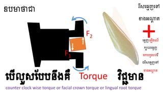 Torque 1 In Orthodontics PPT