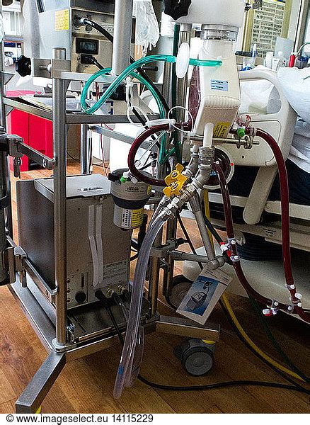 Extracorporeal Membrane Oxygenation Ecmo Extracorporeal Membrane