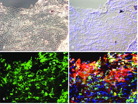 Immunofluorescence Microscopy Of Ilm Surgical Specimen Removed In Download Scientific Diagram