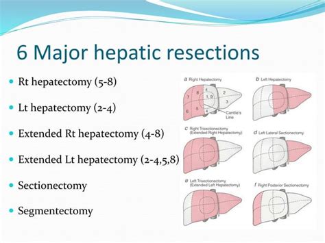 Principles Of Liver Resection Pptx