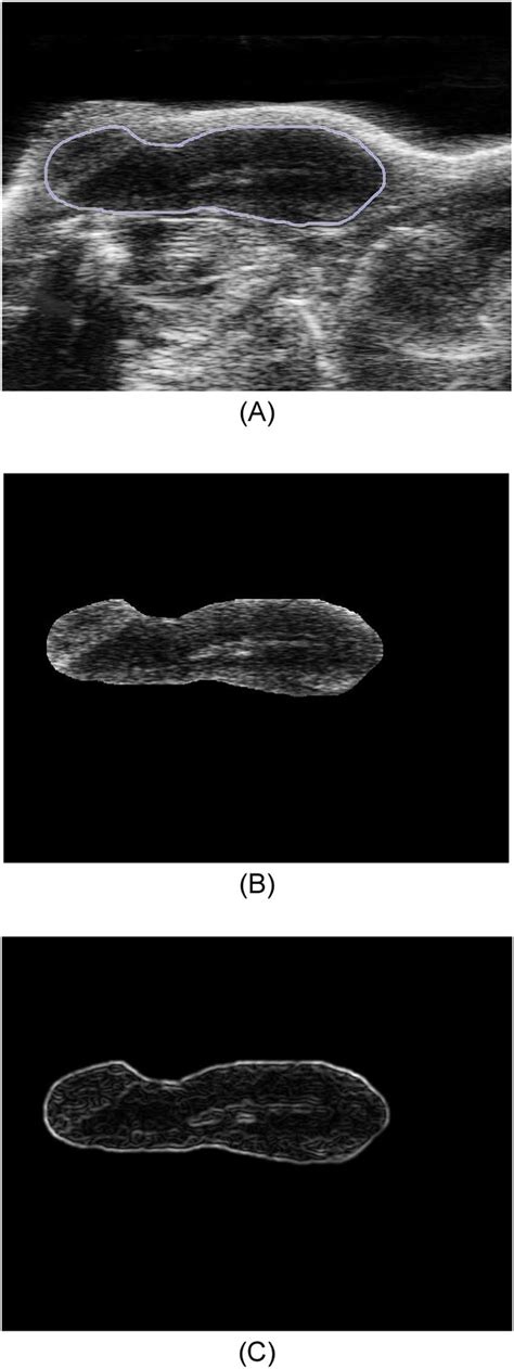 Illustration Of Applying Gaussian Filter To The Ultrasound Image Which Download Scientific