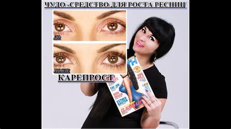 КАПЛИ КАРЕПРОСТ ДЛЯ РОСТА РЕСНИЦ - YouTube