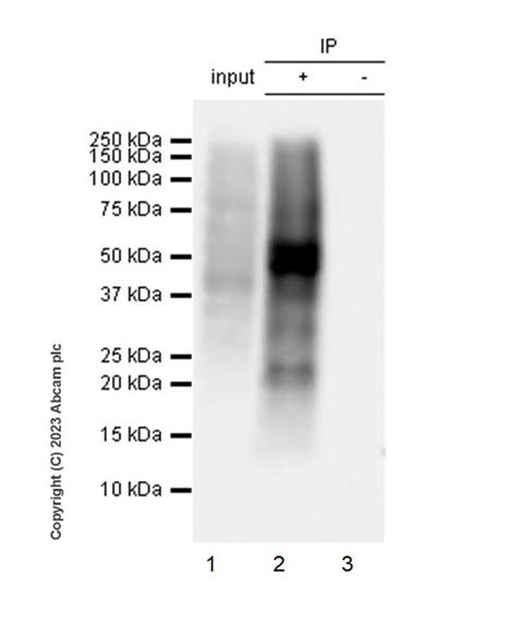 Anti Puromycin Antibody Epr27218 173 Ab315887 Abcam